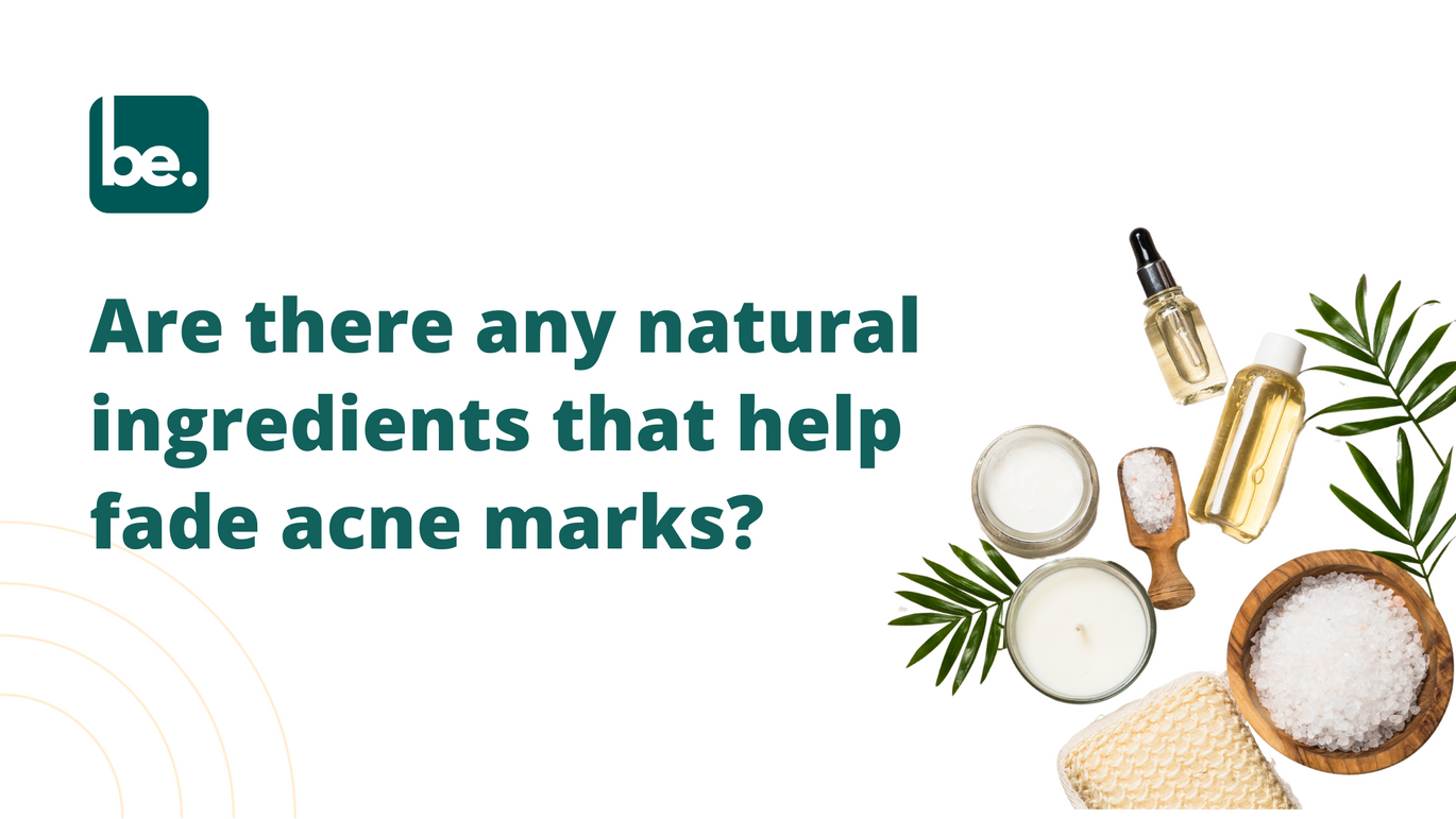 Natural Ingredients That Help Fade Acne Marks - Belogical Wellness ...