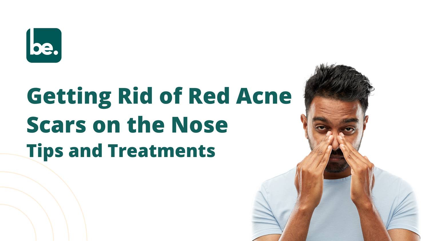 Getting Rid of Red Acne Scars on the Nose: Tips and Treatments ...