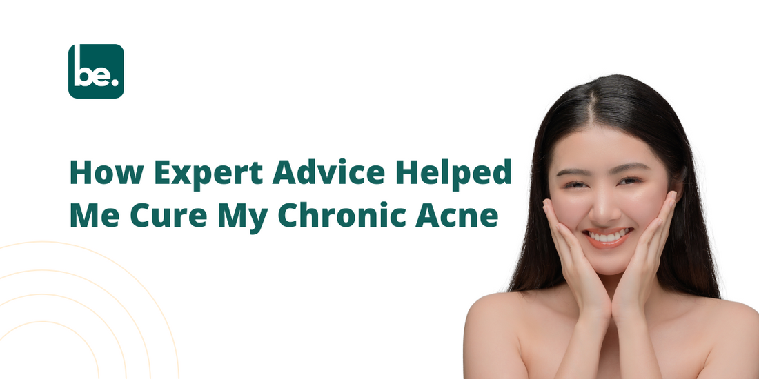 How Expert Advice Helped Me Cure My Chronic Acne - Belogical Wellness ...