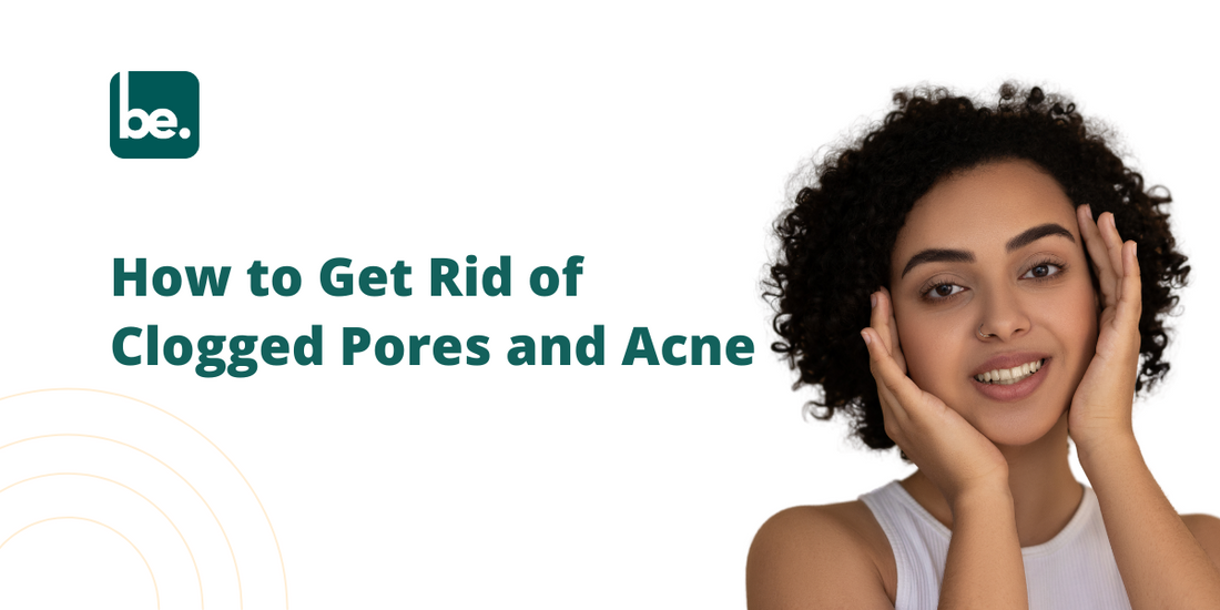 How to Get Rid of Clogged Pores and Acne - Belogical Wellness Private ...